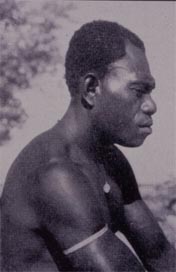 Artificial human cranial deformation